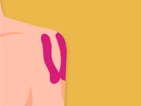 How to Strap a Shoulder for Support: A Full Guide (With Pictures)
